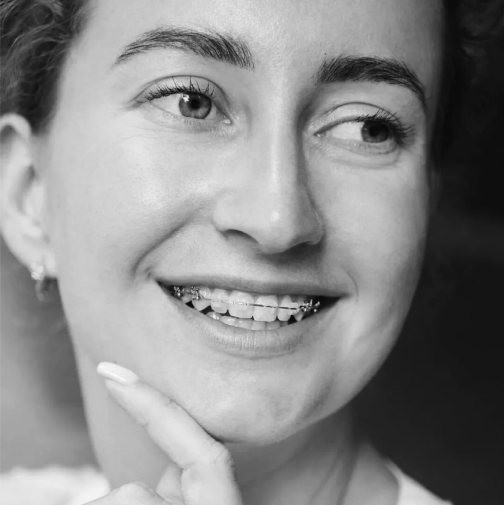 Frenillos cerámicos - Clínica Dental Santa blanca